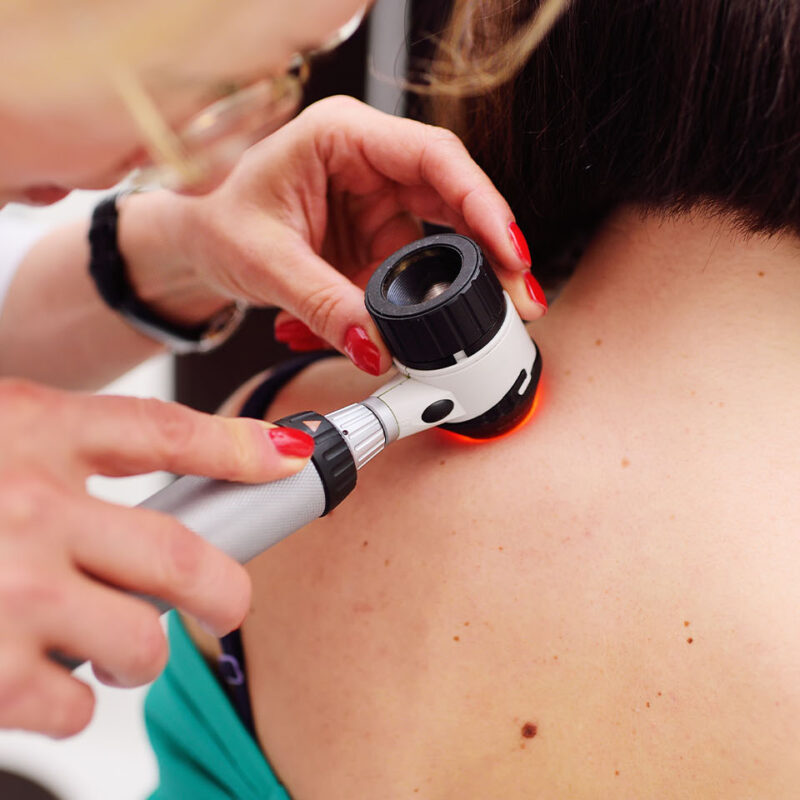 Dermatology - St Thomas Hospital